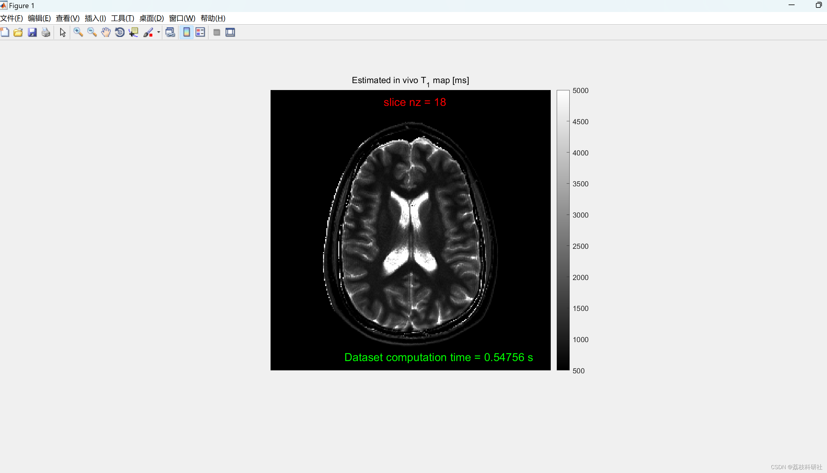 【核磁共振】用于准确和精确的VFA MRI的快速算法研究（Matlab代码实现）_核磁matlab-CSDN博客