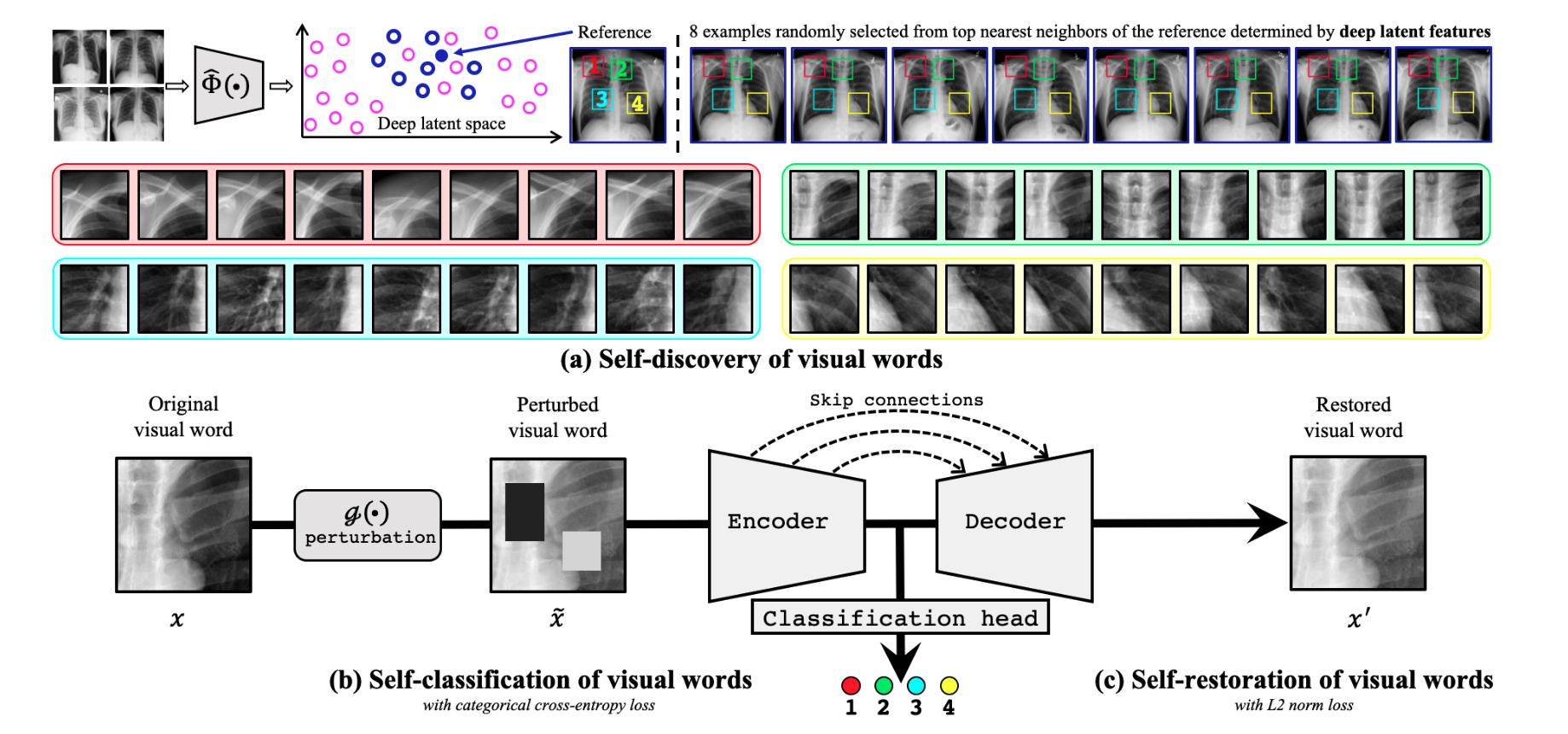 Transferable Visual Words: Exploiting the Semantics of Anatomical Patterns for Self-supervised ...