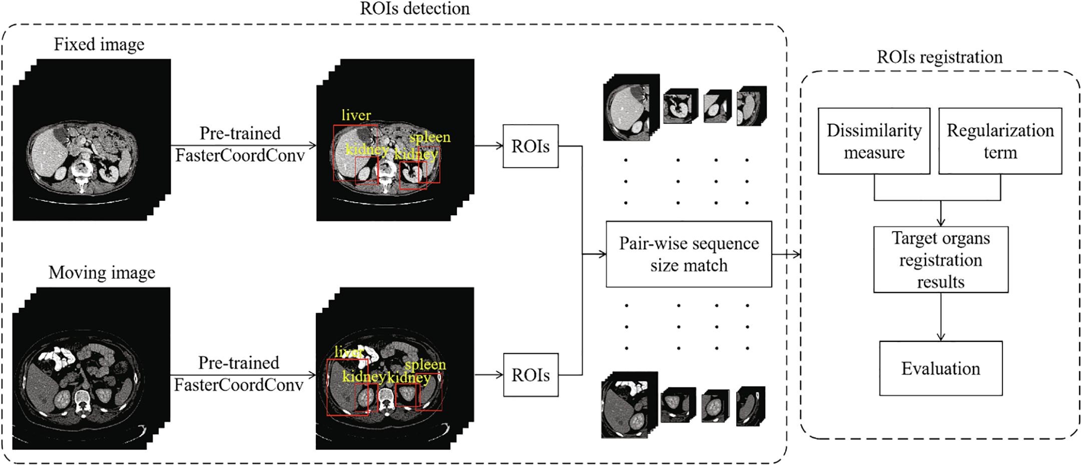 医学图像配准论文学习——基于深度学习的分割方法对腹部CT进行高效的两步多器官配准（2021）；基于深度学习的检测在腹部CT图像上靶器官非刚性配准（2021）；_深度学习的肝脏ct图有几个通道数 ...