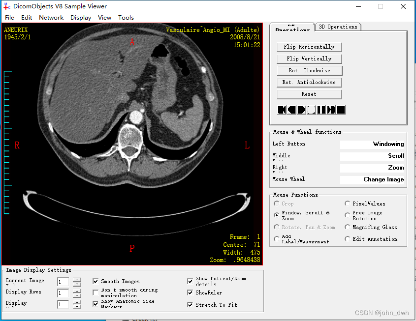 DicomObjects COM 2022-10-18-x86版本使用XP-WIN11_dicomobjects 影像组件-CSDN博客