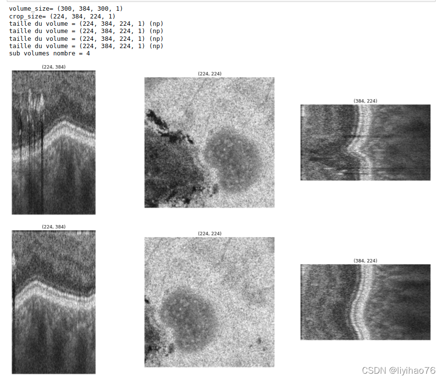 Python 3d医学数据增强 示例代码传统数据增强代码3d Csdn博客