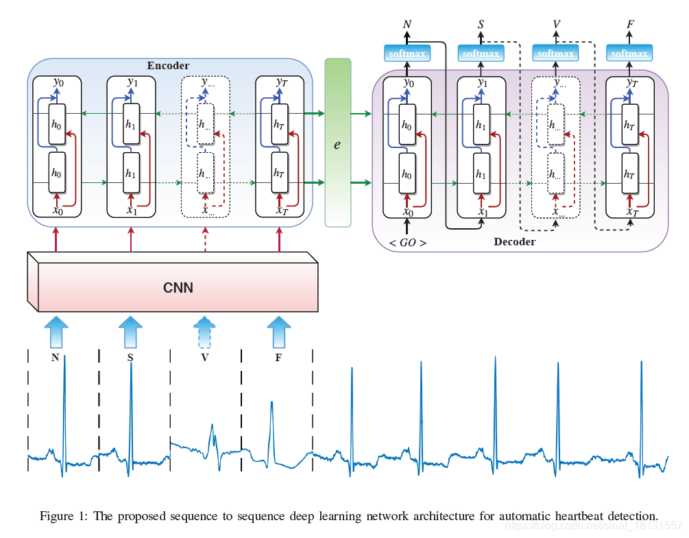 文献笔记——ECG分类器（Inter- and intra- patient ECG heartbeat classification）-CSDN博客