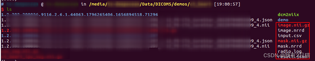 【组学计算 pyradiomics】可算是玩明白了!!!-CSDN博客