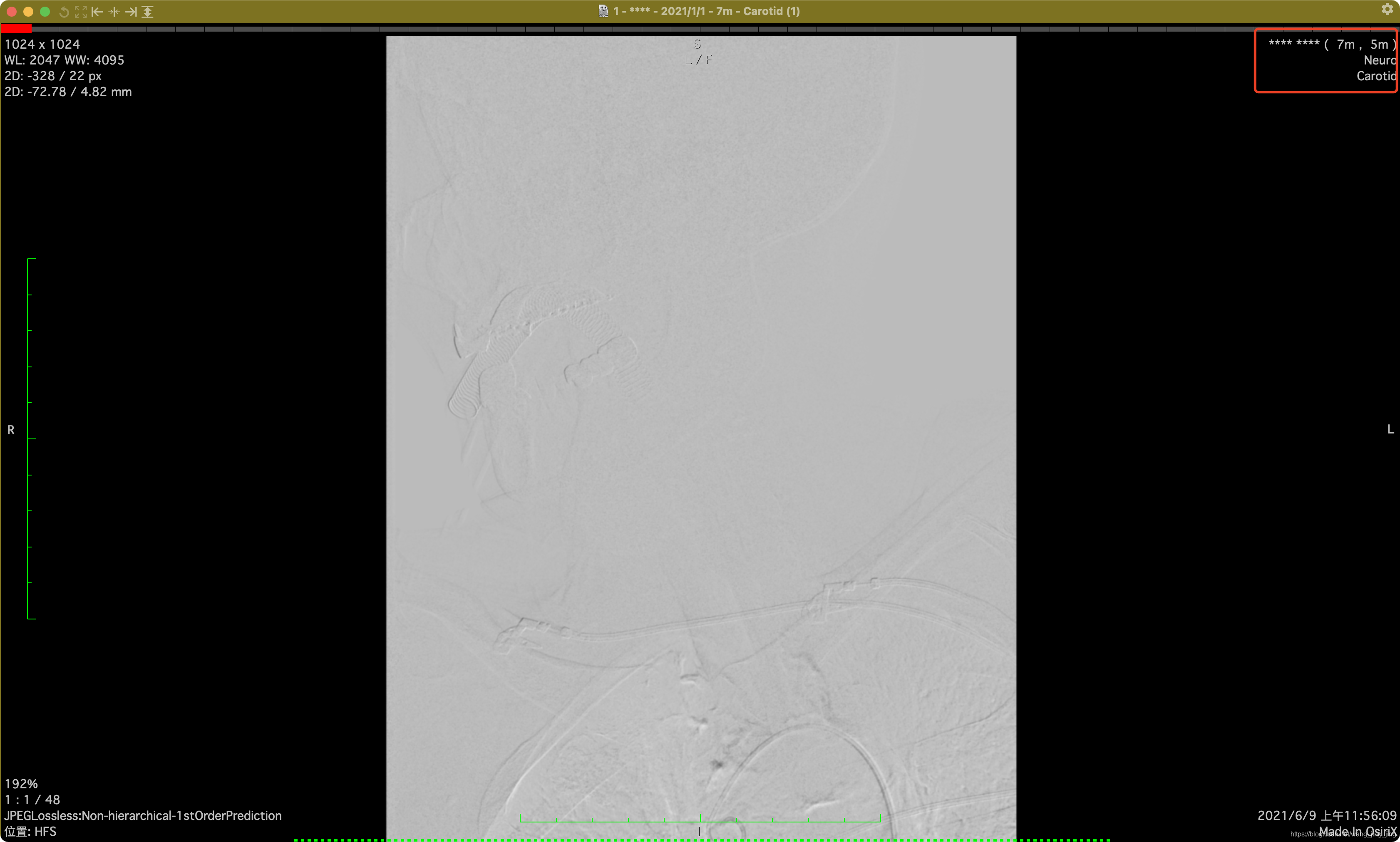 使用 dcm4che 操作 Dicom 文件-CSDN博客