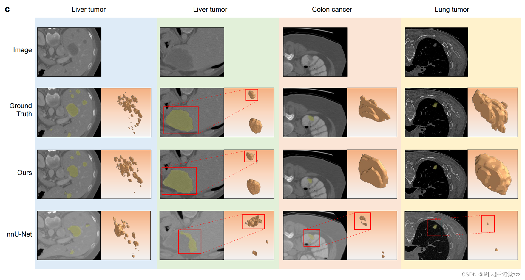 3D医学图像分割大模型 SegVol: Universal and Interactive Volumetric Medical Image Segmentation-CSDN博客