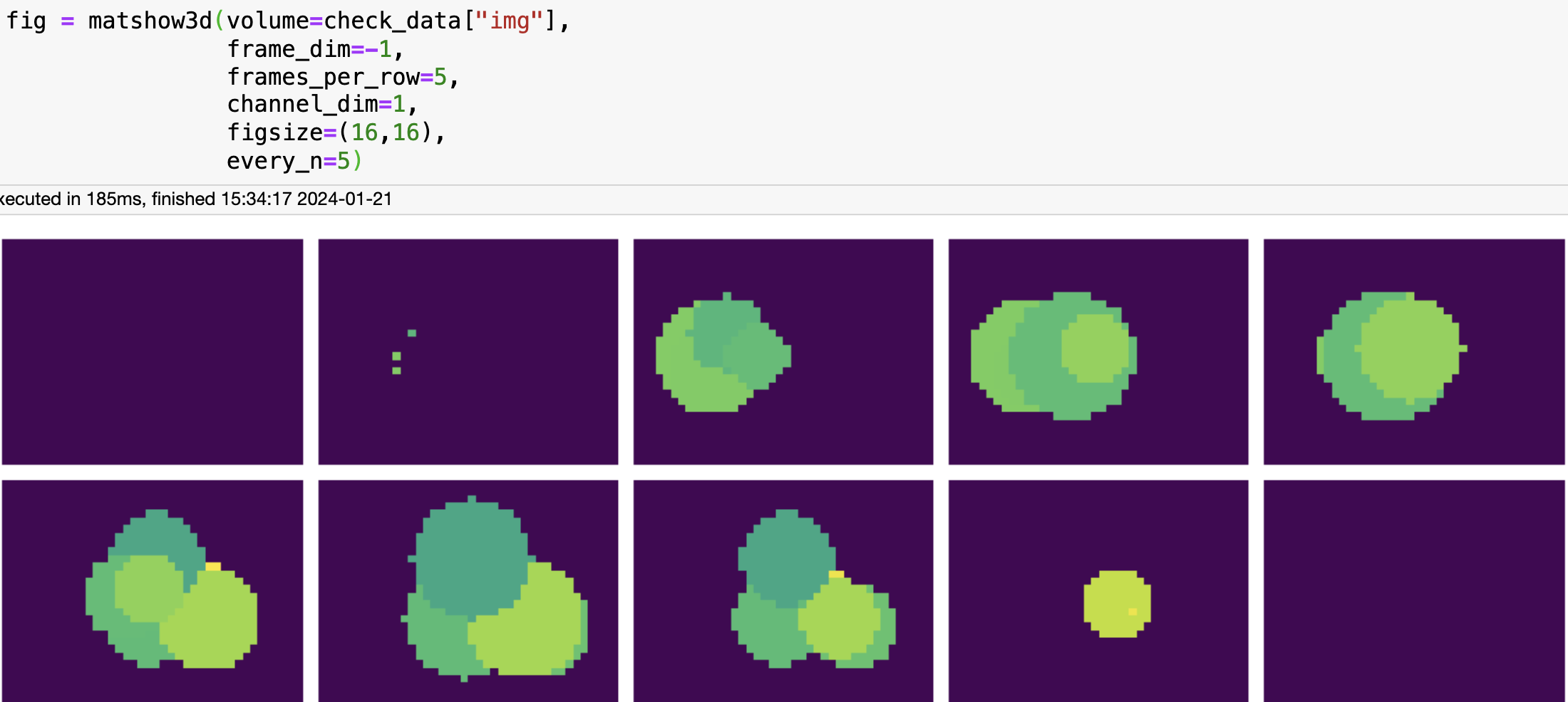 从三维图像中抽取2D样本进行训练-MONAI实战_monai 1.3.0-CSDN博客