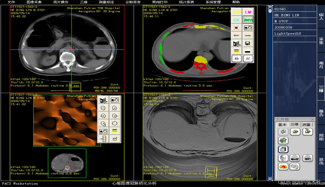 PACS（CT、CR、DR、MR、DSA、RF医院影像管理系统源码）_c# 影像系统源码-CSDN博客