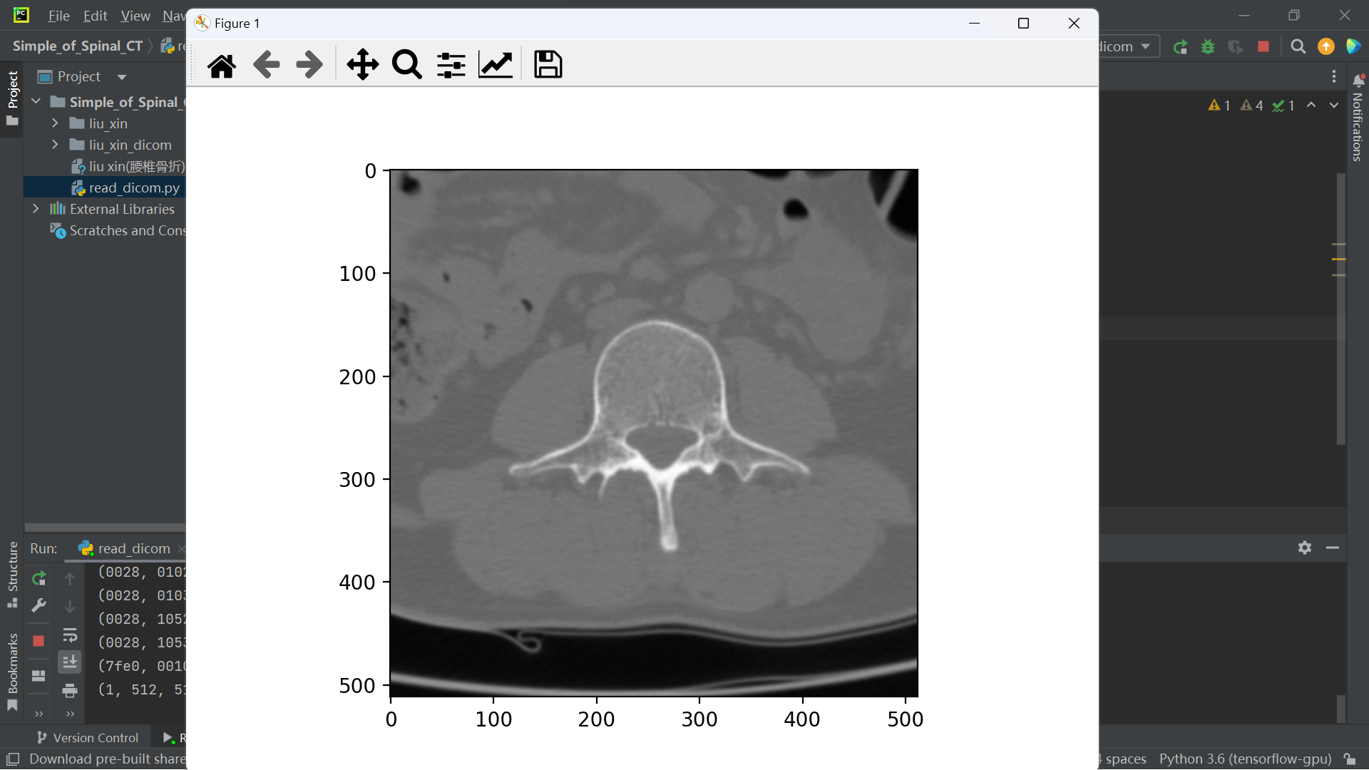 医学影像处理：NIFTI与DICOM格式详解及Python操作-CSDN博客