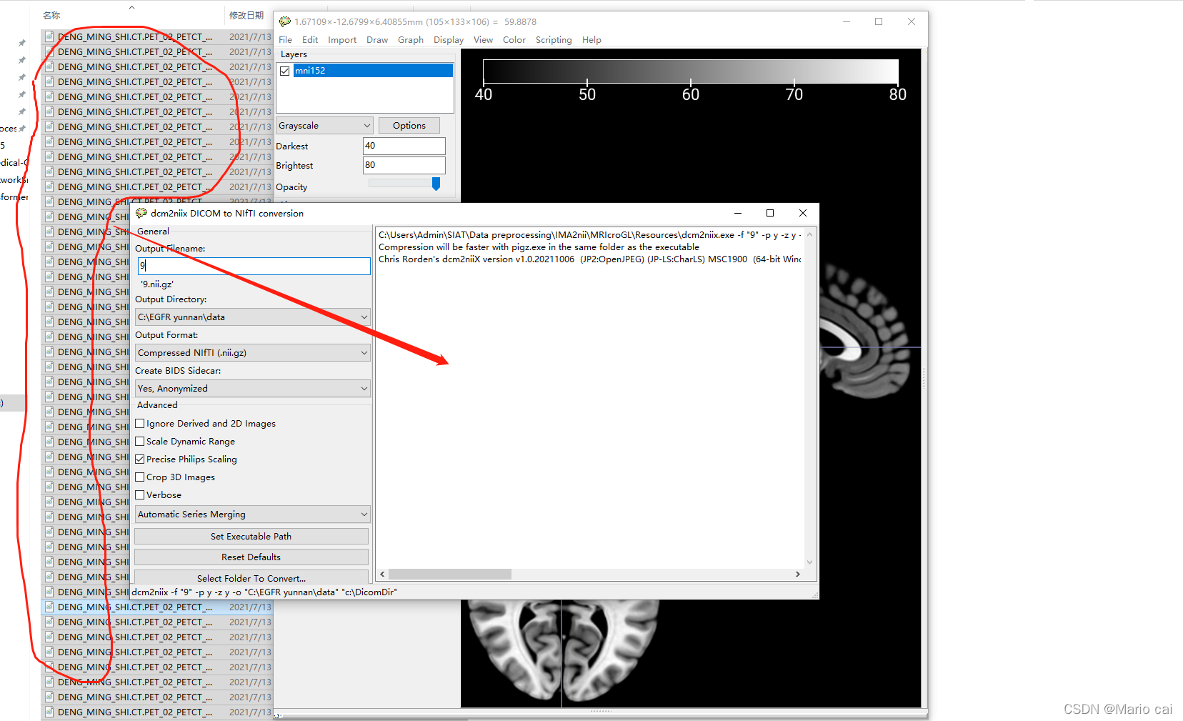 多个单张IMA转一个nii_ima文件怎么转成nifft-CSDN博客