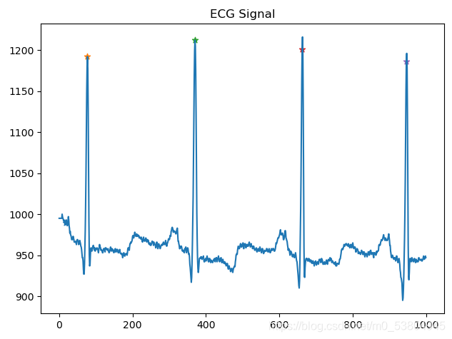 Deep Learning × ECG (2) ：利用WFDB包读取心律失常ECG数据-CSDN博客