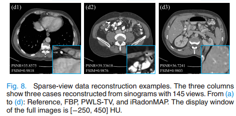 Radon Inversion via Deep Learning_iradonmap-CSDN博客