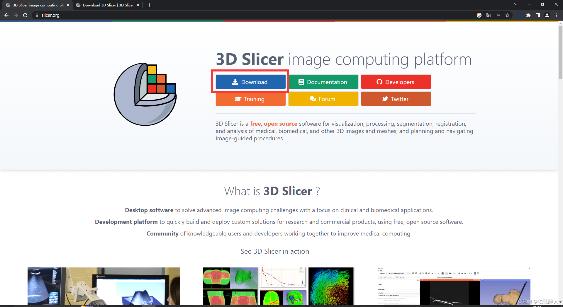 使用3D Slicer进行图像配准_使用3dslicer配准lpba40-CSDN博客