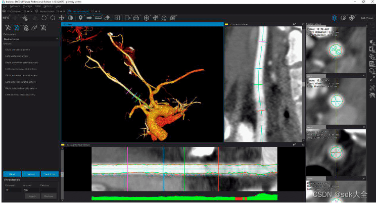 INOBITEC DICOM VIEWER 12.2 Crack_inobitec dicom viewer 2.12 pro crack ...