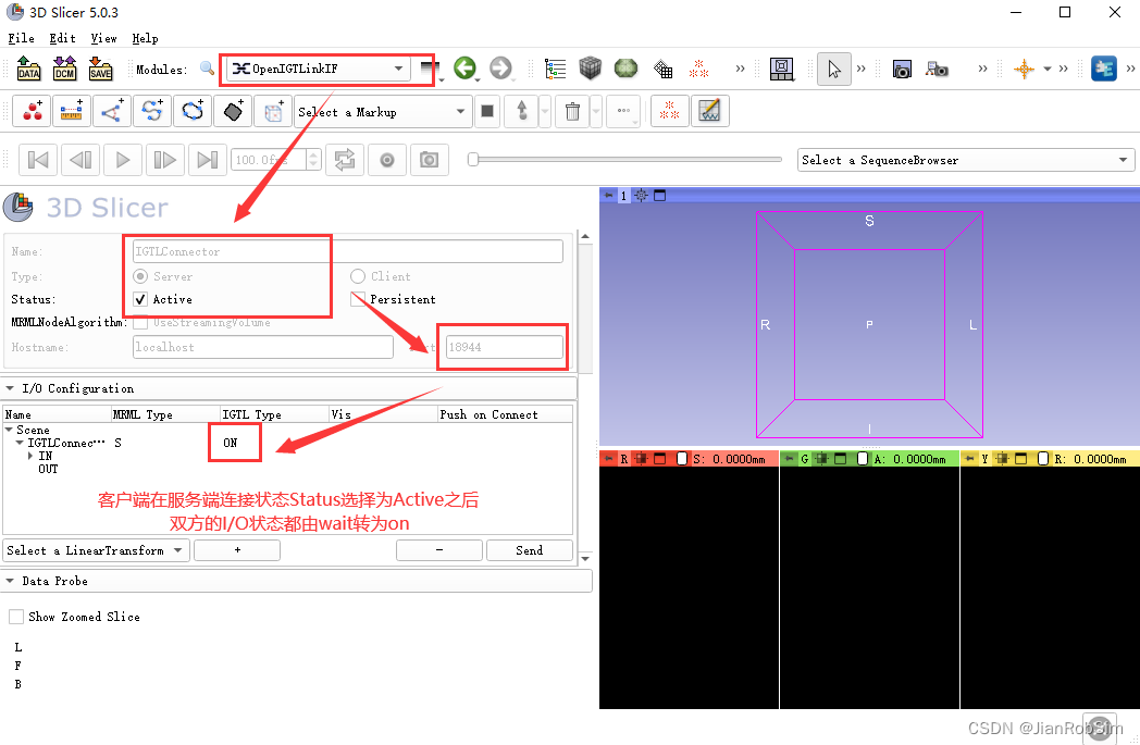 3d Slicer学习记录（0） 利用openigtlink实现数据发送接收 医学图像导航与机器人手术控制 Csdn专栏
