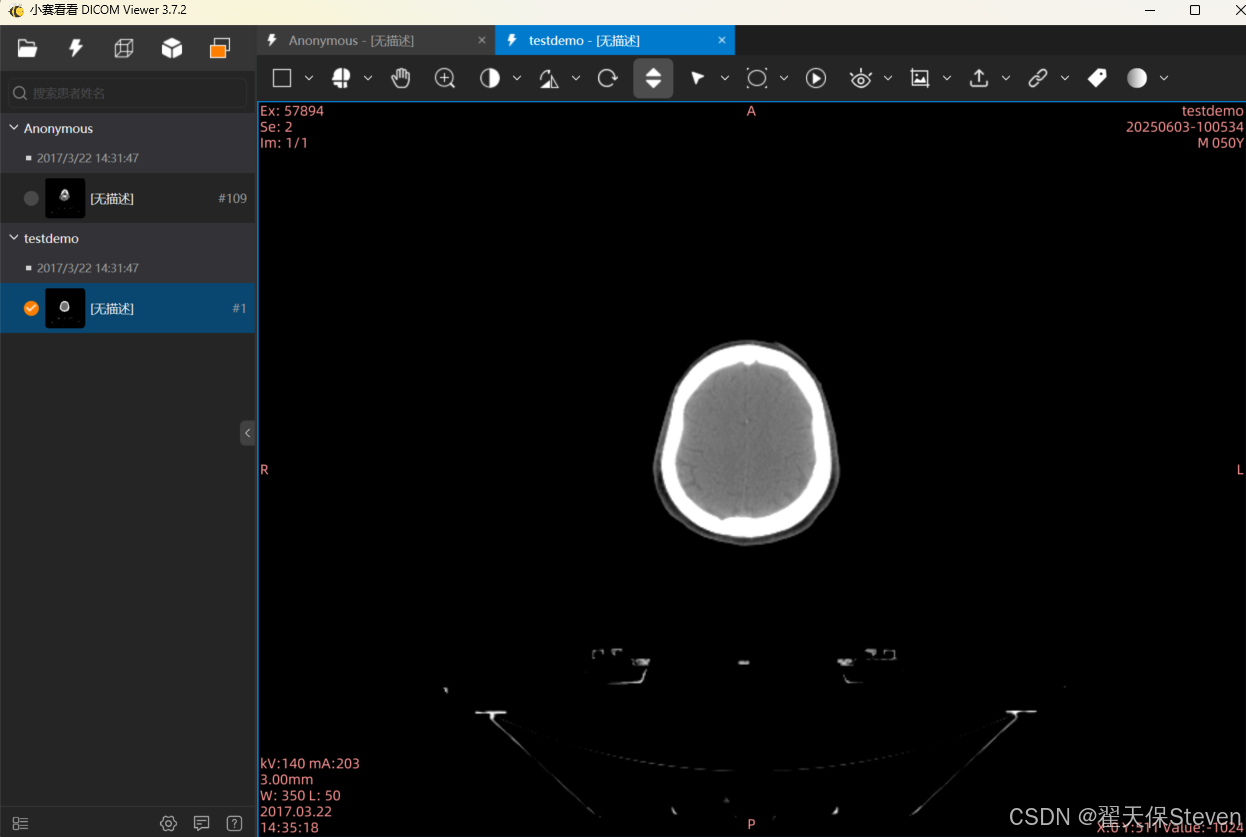 DCMTK-读取、修改、保存DICOM数据_dicom信息修改-CSDN博客