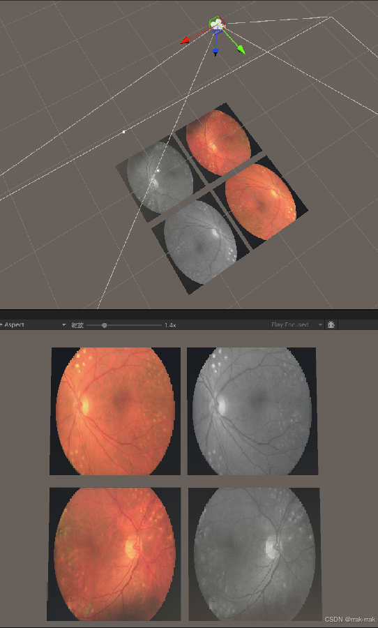 fo-dicom在unity中显示dicom图像基本方法_unity dicom-CSDN博客