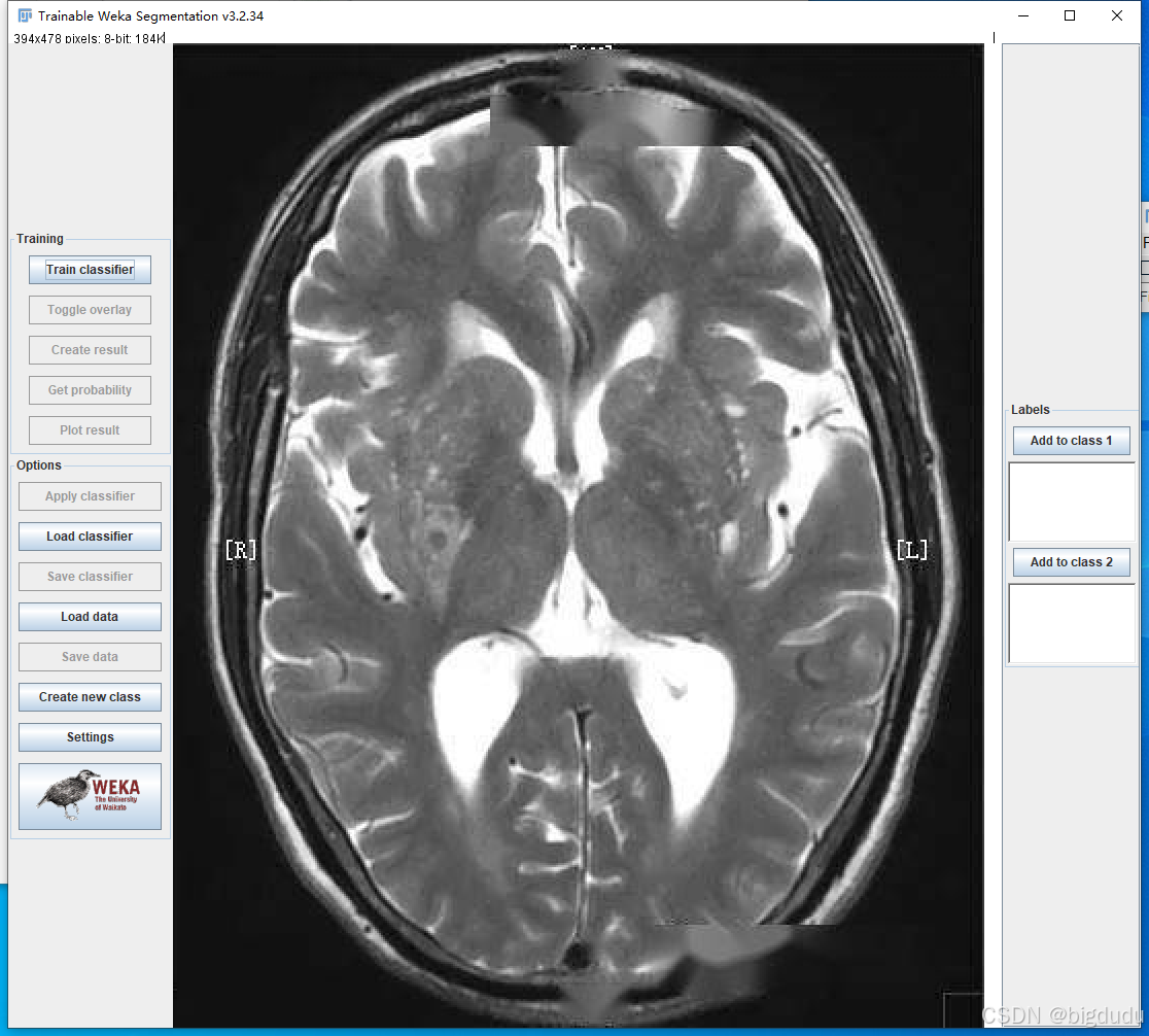傻瓜式ImageJ可训练的图像分割_imagej weka-CSDN博客