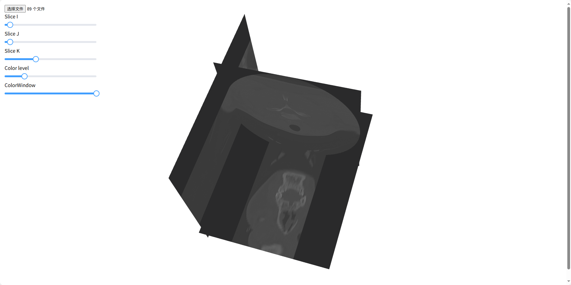 vite+vue3+ITK-wasm+VTK.js 编写Dicom阅片器_vue dicom-CSDN博客