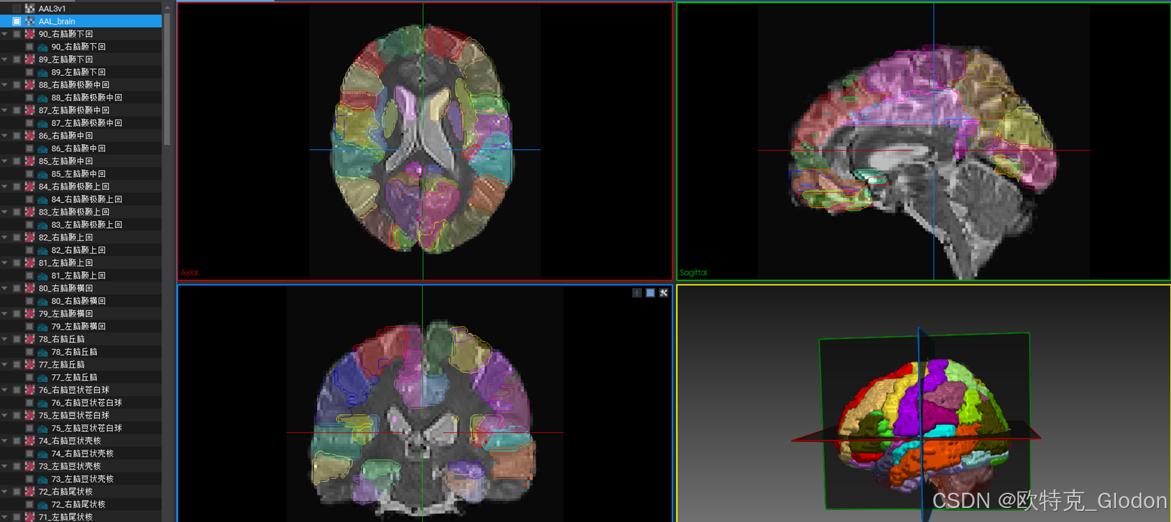 3D医学影像开发＜七＞：利用AAL模板实现脑功能区的自动划分-CSDN博客