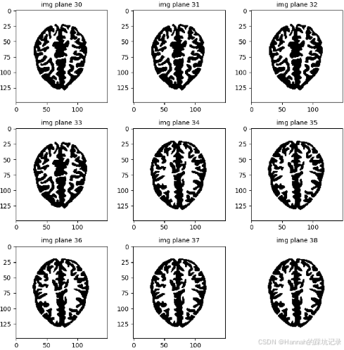 手把手Parallelproj重建PET hoffman数字体模(sinogram MLEM重建)-CSDN博客