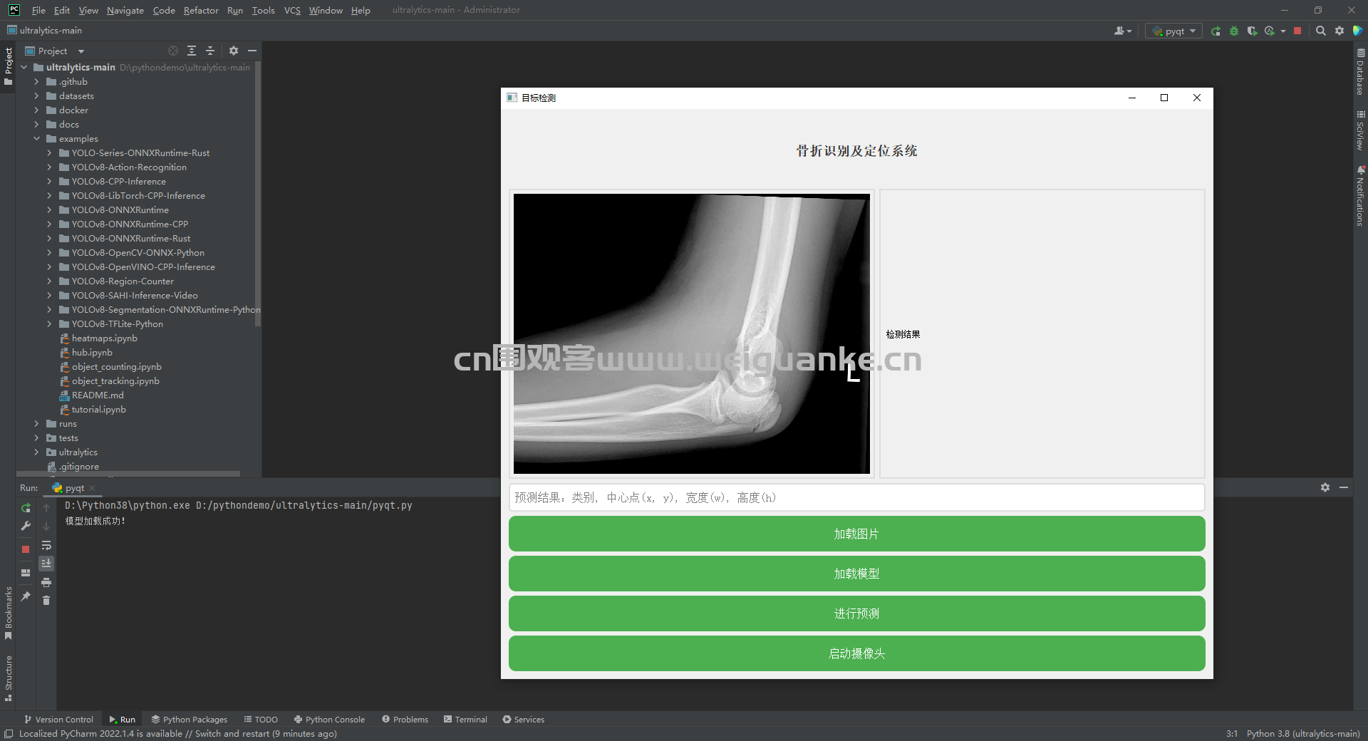 骨折识别及定位系统-python+yolo8_骨折智能识别系统-CSDN博客
