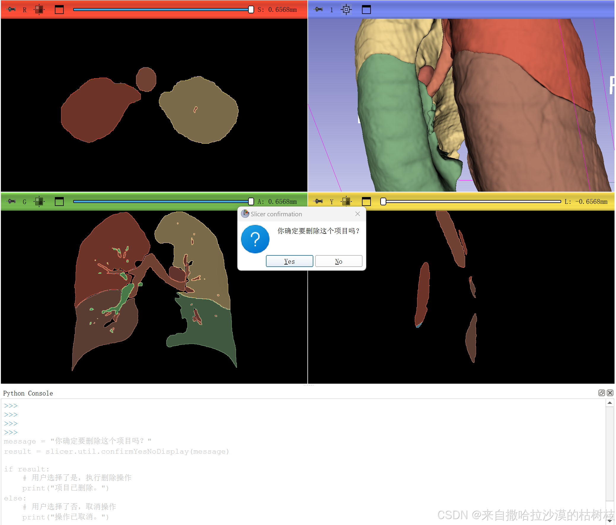 3d slicer python插件制作(二) slicer.util函数方法的试验-CSDN博客