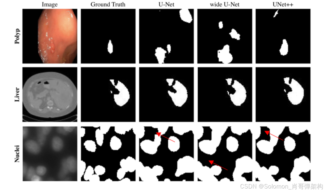 Python U Net 实现医学影像分割 Csdn博客