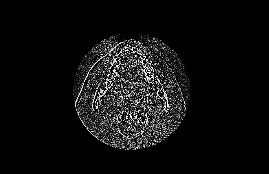 VTK API 详解（99）：vtkImageSobel3D - 三维Sobel边缘检测-CSDN博客