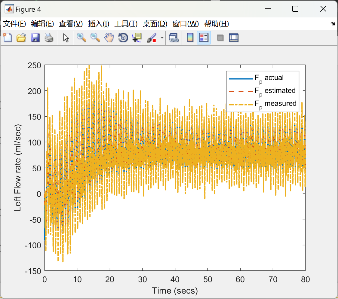 旋转双心室辅助装置的无传感器生理控制、防吸和流量平衡算法（Matlab代码实现）-CSDN博客