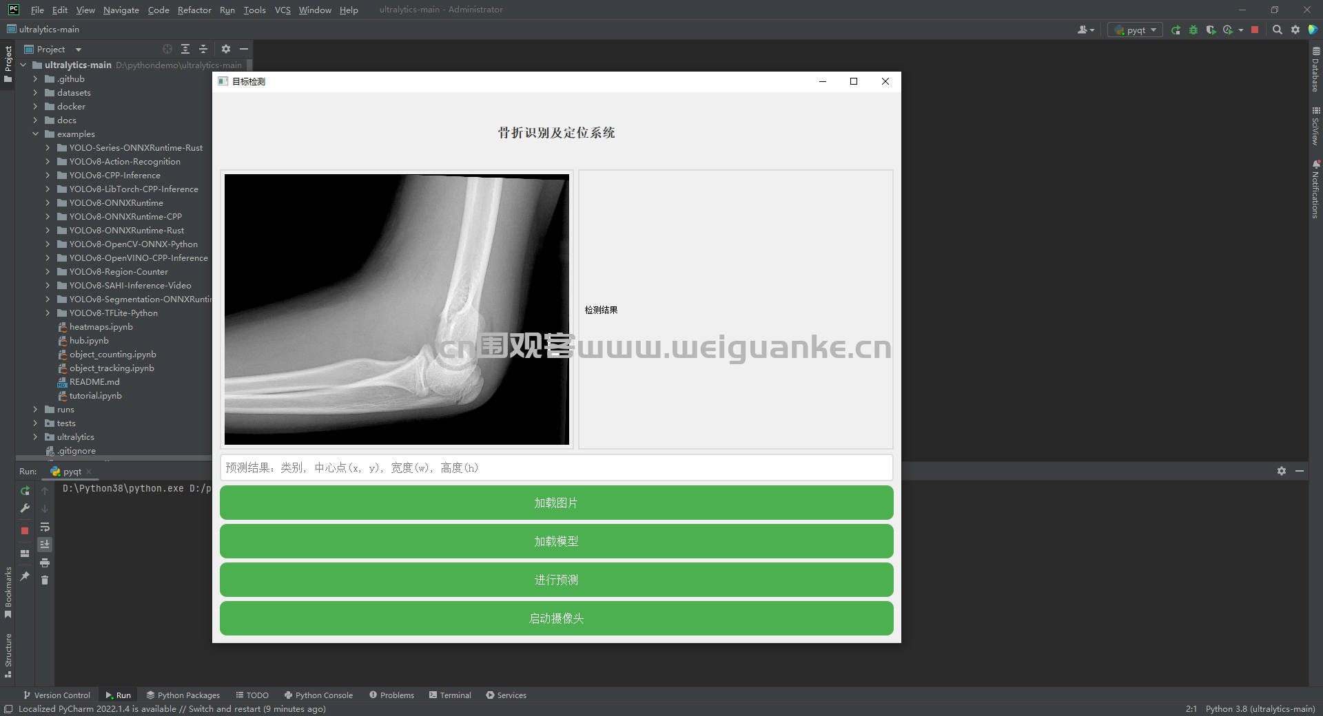 骨折识别及定位系统-python+yolo8_骨折智能识别系统-CSDN博客