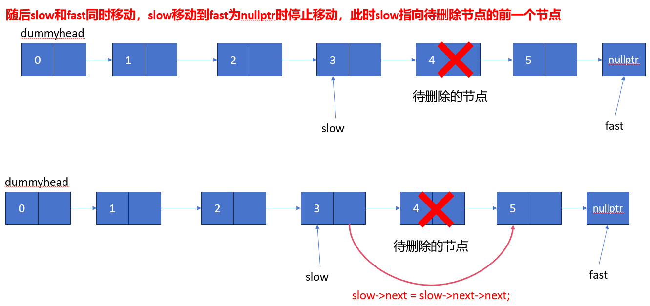 Leetcode19 删除链表的倒数第n个节点leetcode 删除列表的倒数第n个节点 Csdn博客