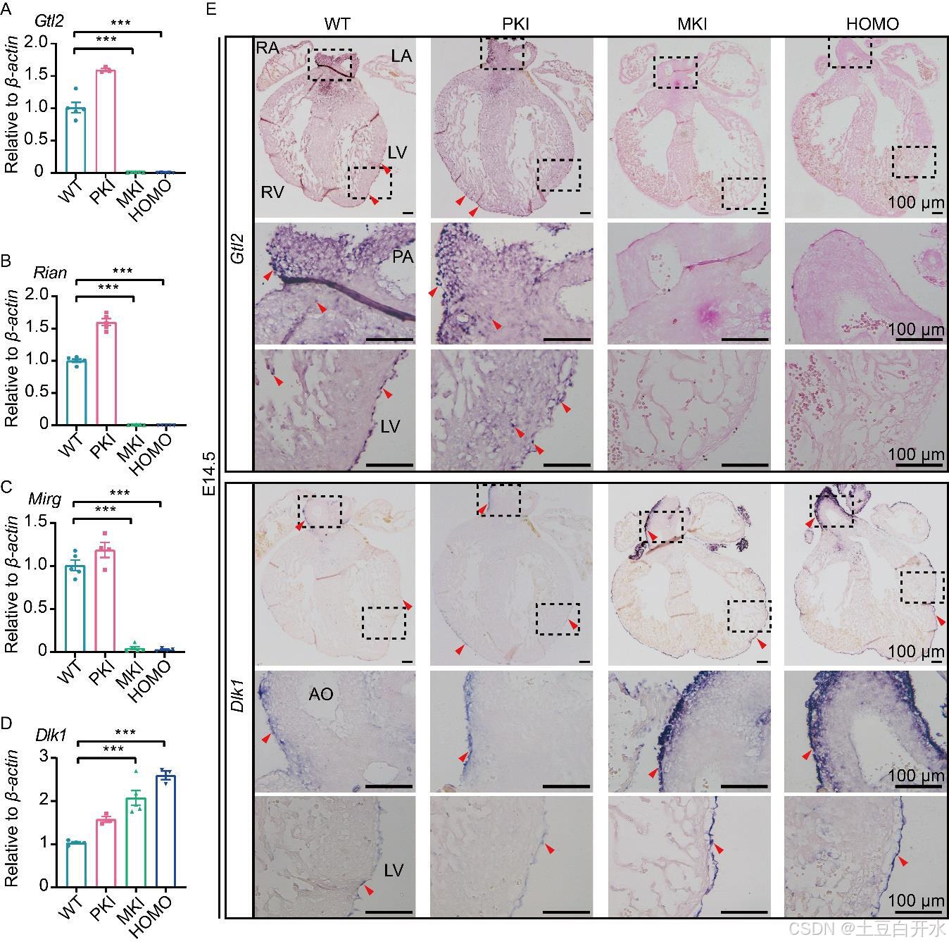 LncRNAs in the Dlk1-Dio3 Domain Are Essential for Mid-Embryonic Heart ...
