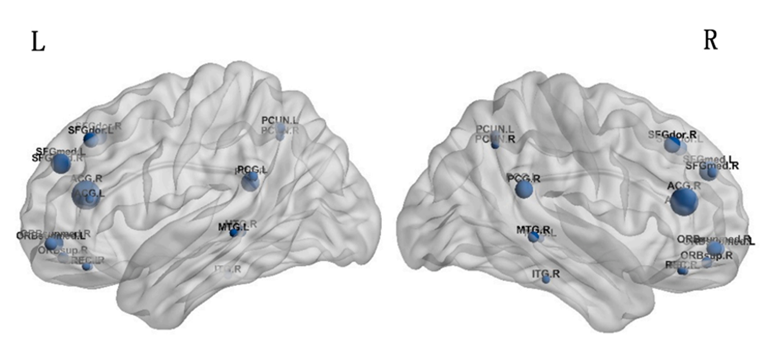 BrainNet Viewer绘图教程——脑研究可视化一站式解决-CSDN博客