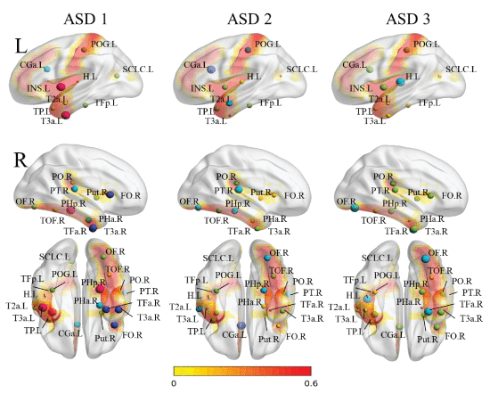[论文精读]EAG-RS: A Novel Explainability-Guided ROI-Selection Framework for ASD Diagnosis via Inter ...