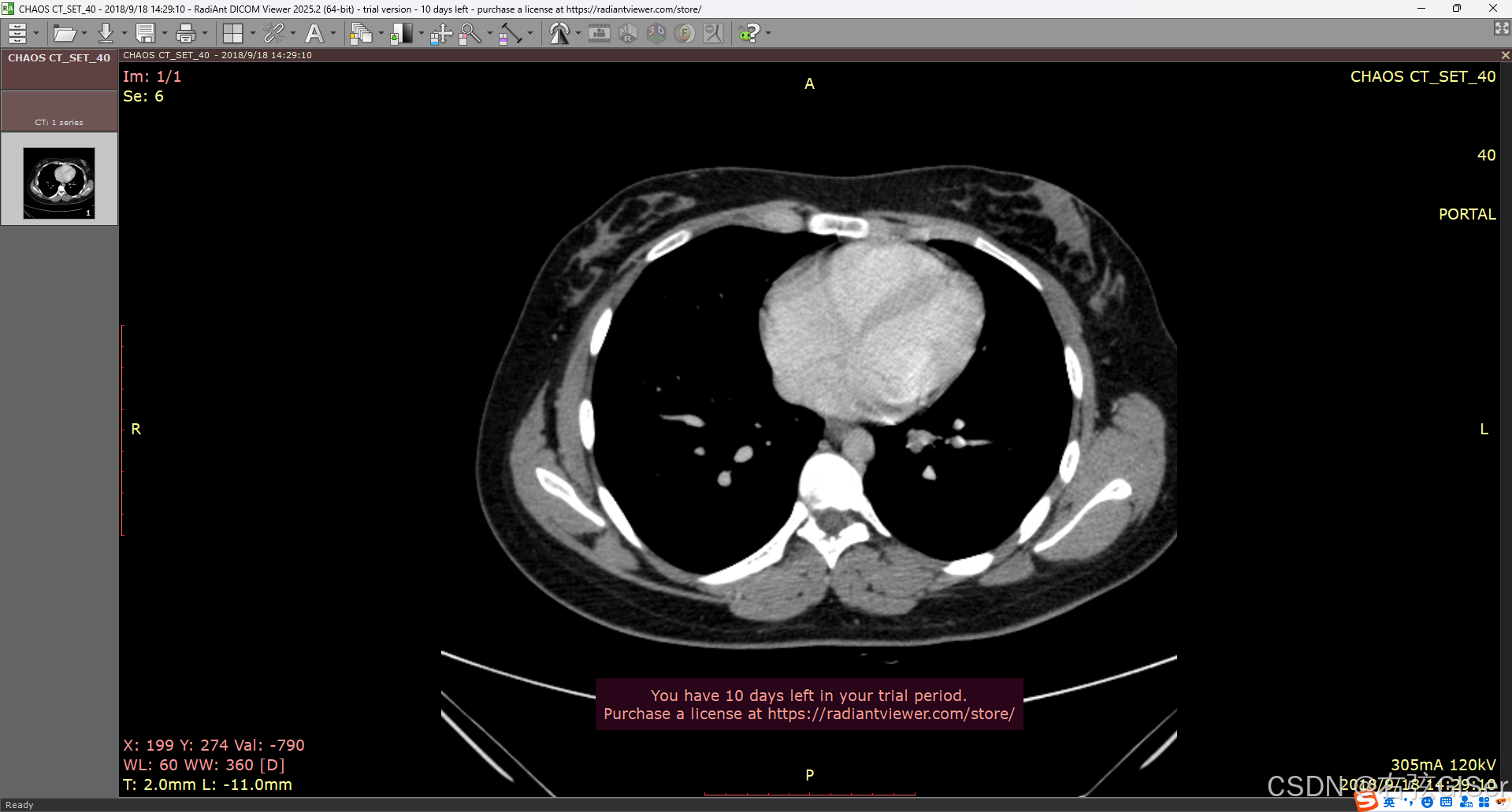 【医学影像】之GDCM库编译（windows环境）与简单使用-CSDN博客