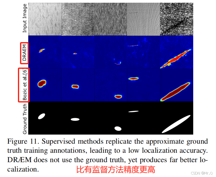 DRÆM无监督异常检测（CVPR2021)_draem异常检测-CSDN博客