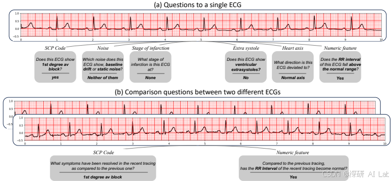 ECG-QA: A Comprehensive Question AnsweringDataset Combined With Electrocardiogram-CSDN博客