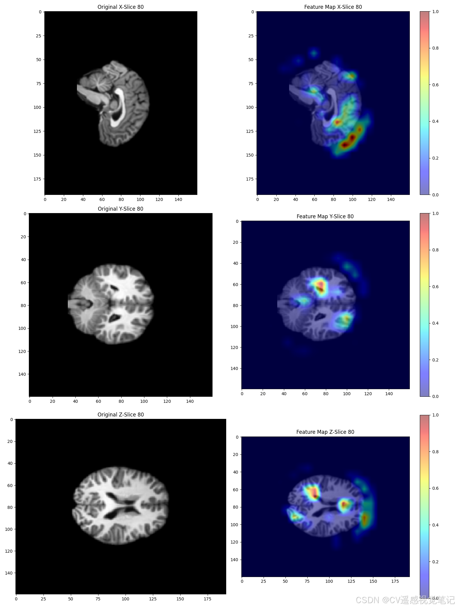 手把手教你用Grad-CAM可视化医学3D影像_3d grad-cam-CSDN博客