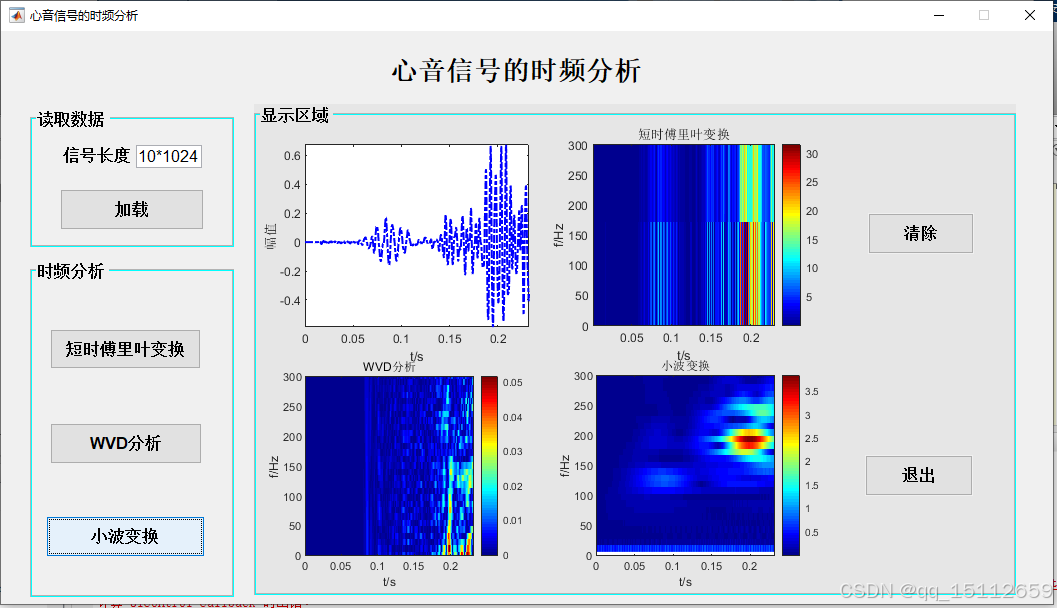 短时傅立叶+小波变换+WVD心音分析-CSDN博客