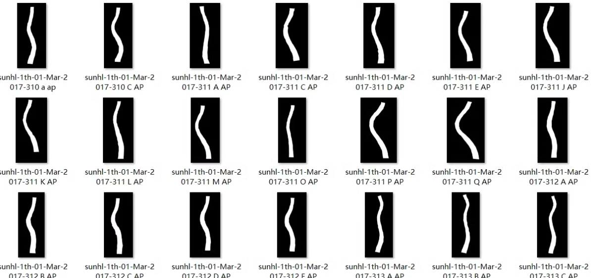 基于U-Net的CT脊柱语义分割：从CT脊柱语义分割数据集准备到GUI应用_unet分割ct数据集-CSDN博客
