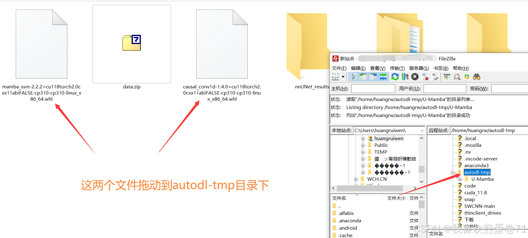 U-Mamba复现_umamba复现-CSDN博客