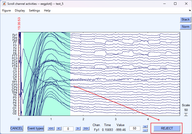 eeglab-基础篇（数据预处理）-CSDN博客