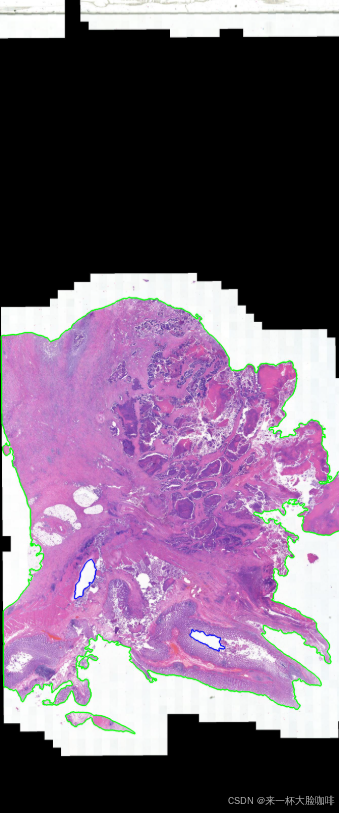 Deepzoom和Openslide处理WSI时的异同及问题解决_openslide读取wsi-CSDN博客