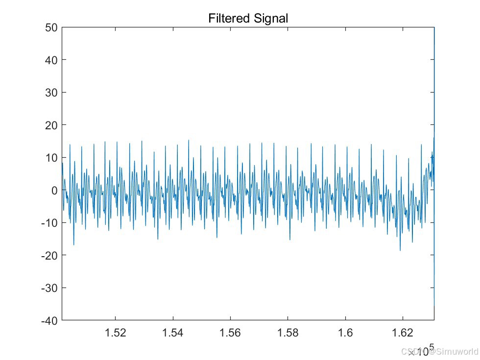 基于带通滤波的ECG信号P波检测matlab仿真-CSDN博客
