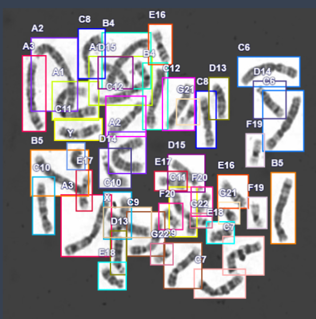 染色体识别检测数据集，可识别A1 A2 A3 B4 B5 C10 C11等染色体，4994张图片并用yolov，coco，voc标记_染色体数据集-CSDN博客