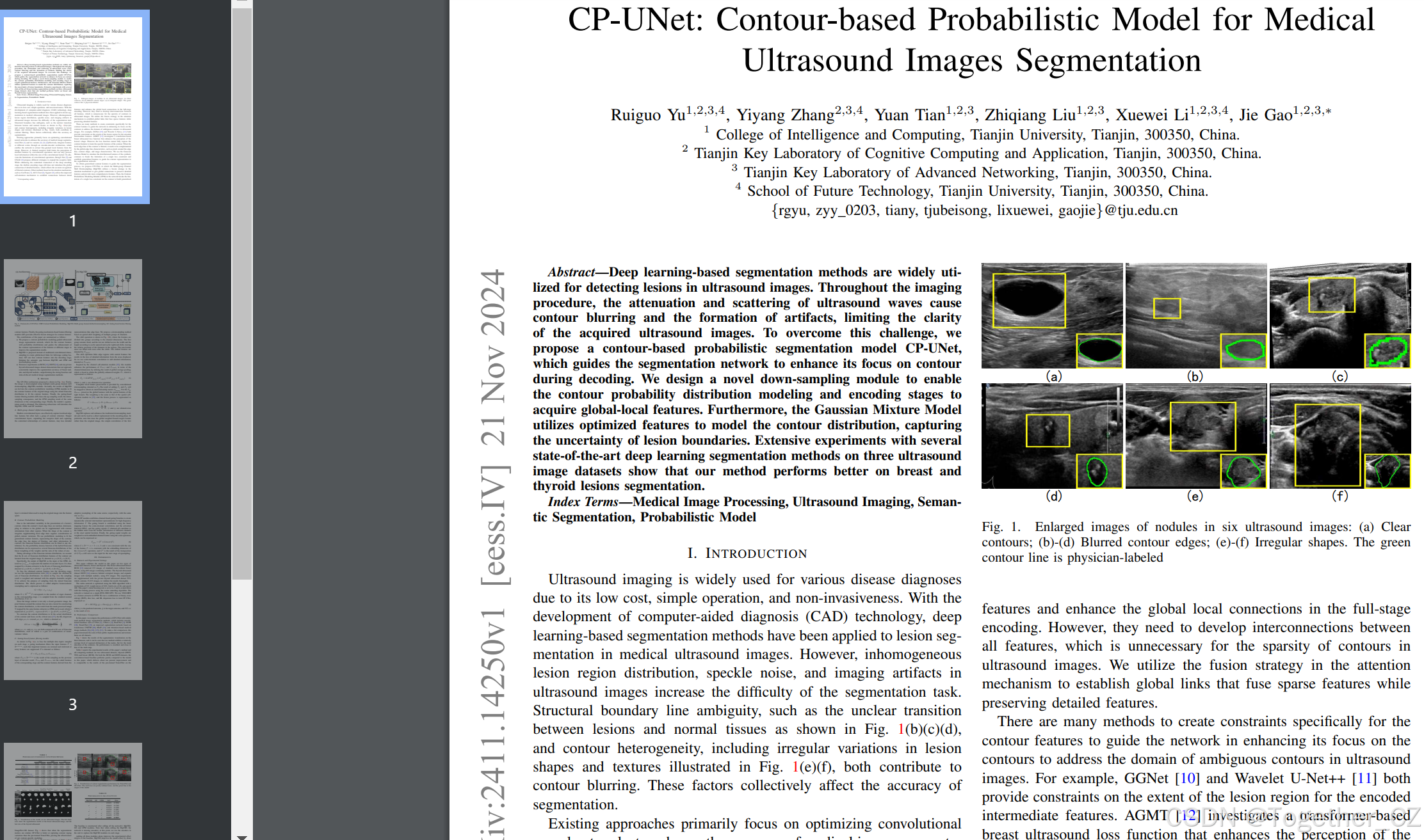 CP-UNet:Contour-based Probabilistic Model for MedicalUltrasound ImagesSegmentation基于轮廓的概率模型为医学超声 ...
