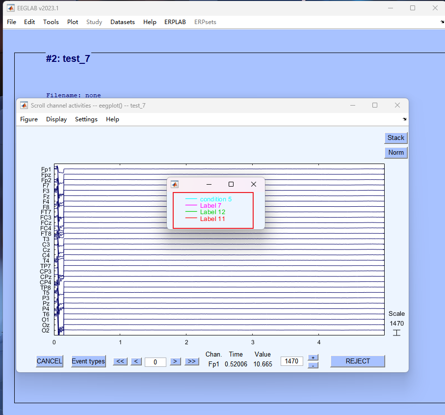 eeglab-进阶篇（ERP）_eeglab里画地形图,同时画几个图时,如何让这些图横向排列呢?在菜单中如何操作-CSDN博客