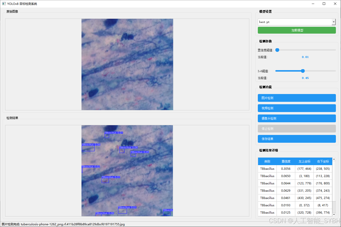 基于深度学习的结核病检测系统（YOLOv8+YOLO数据集+UI界面+Python项目+模型）_结核杆菌数据集-CSDN博客