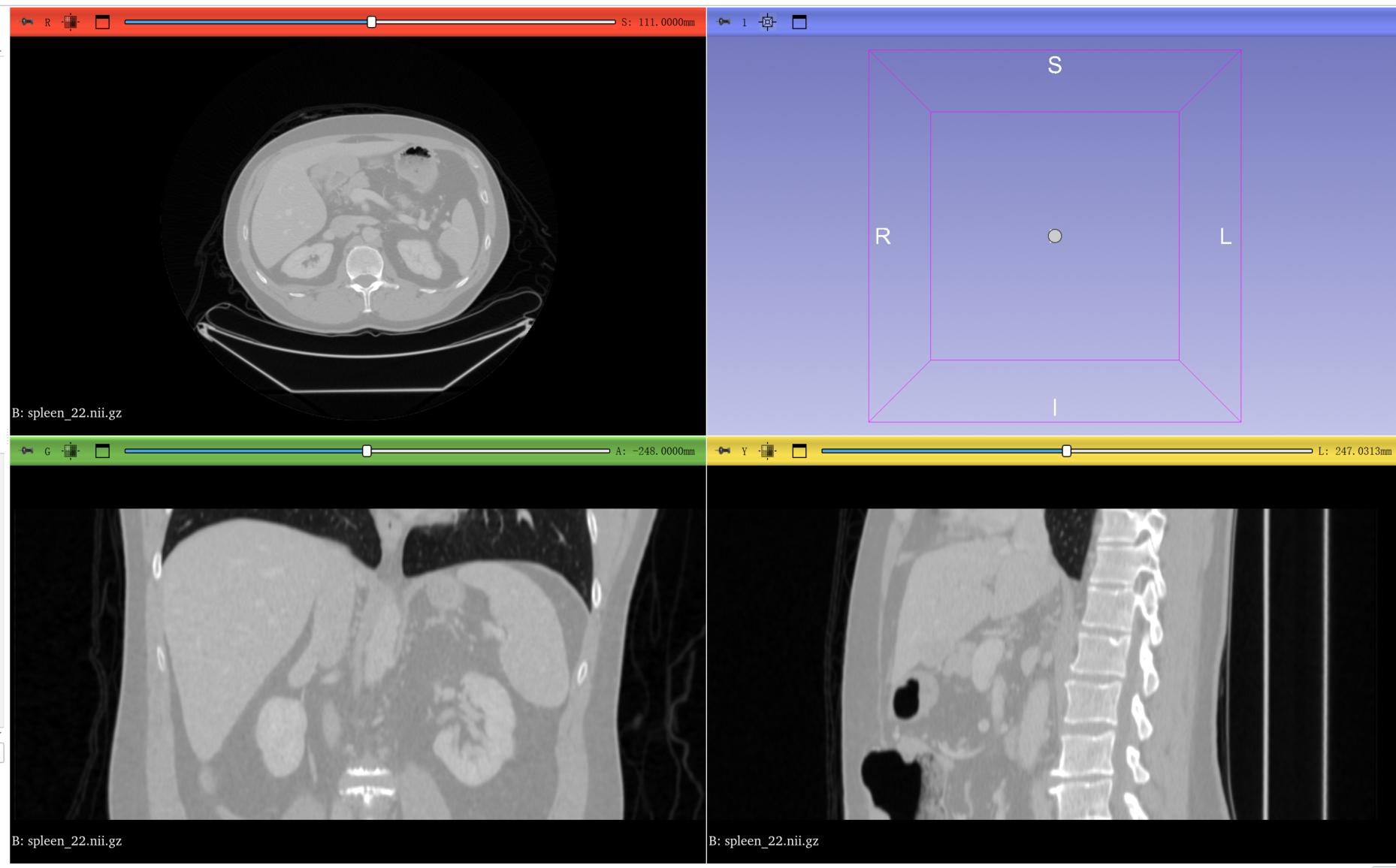 在3D slicer中使用MONAI Label-CSDN博客