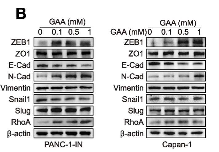 AbMole蛋白酶抑制剂Cocktail：让WB实验赢在起跑线上-CSDN博客